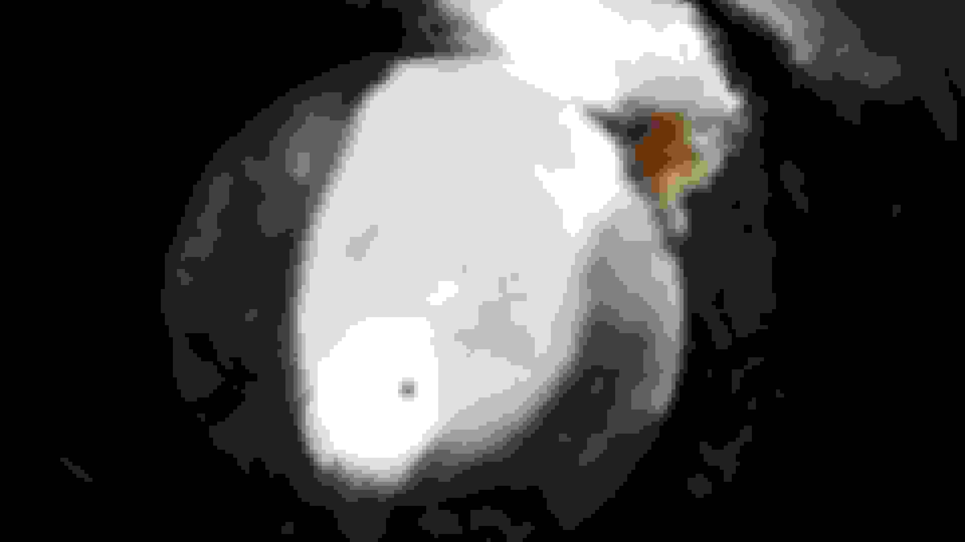 B8.5 Stuttering/Misfire Code P030400 - Page 2 - AudiWorld Forums
