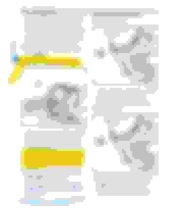Fluids draining / elsd module air bleed question - CorvetteForum - Chevrolet Corvette Forum ...
