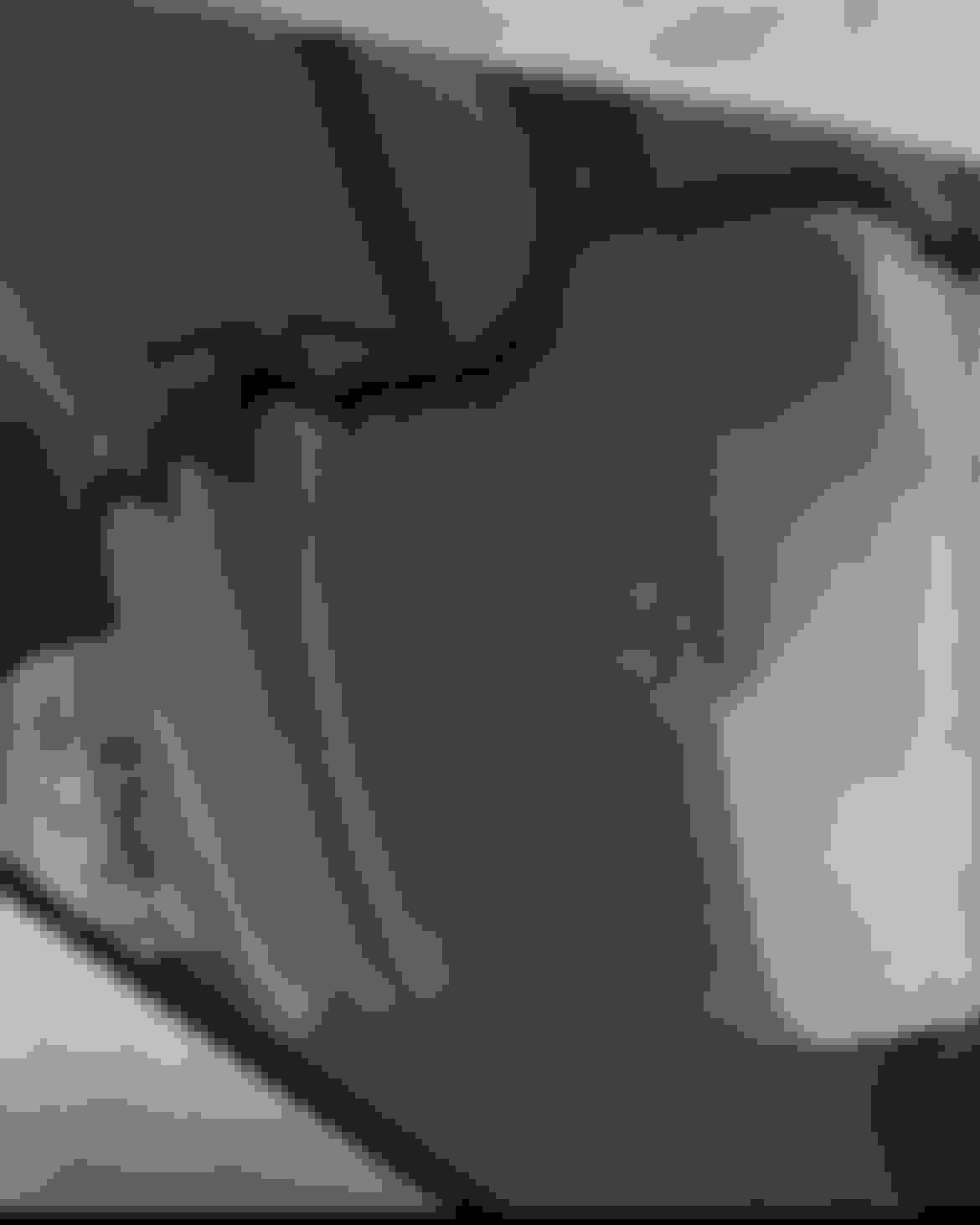 Rear Axels Rubbers Greasy - MBWorld.org Forums